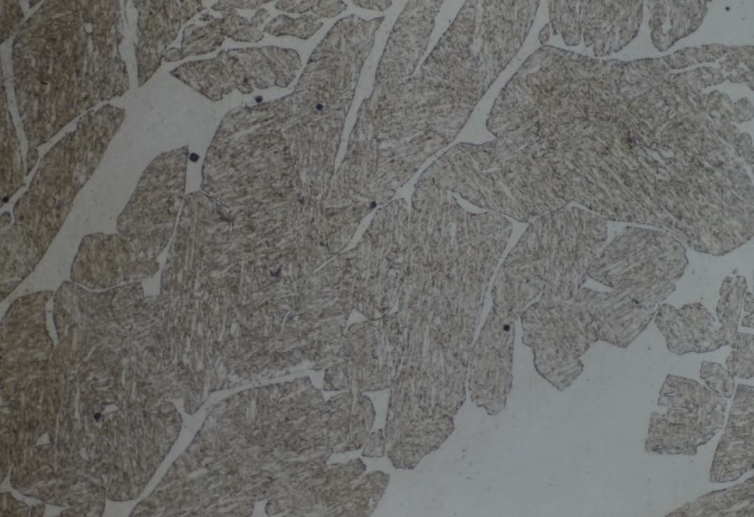 Metallographic Sample Preparation Guides | Metallography.org ...